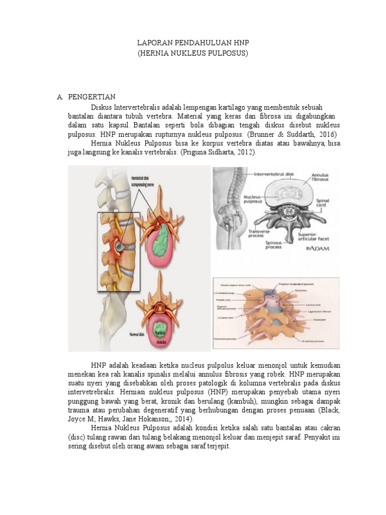 Laporan Pendahuluan HNP Baru | PDF