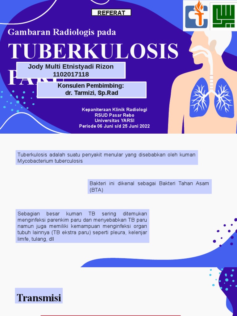 Referat Gambaran Radiologis TB Paru | PDF