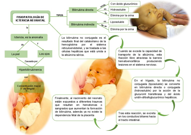 Ictericia Neonatal | PDF | Hígado | Enfermedades y trastornos