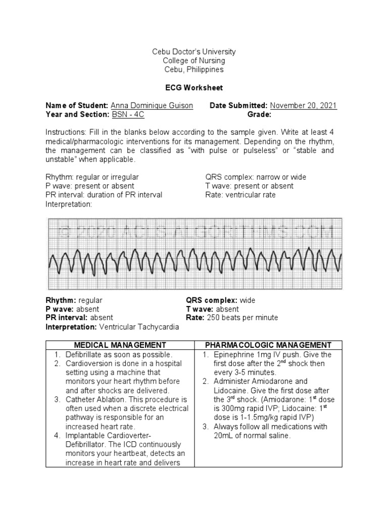 ECG Worksheet | PDF | Artificial Cardiac Pacemaker | Heart