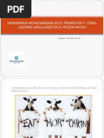 Hemorragias en la matriz germinal: revisión | PDF | Especialidades ...