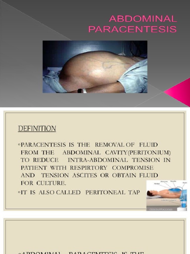 Abdominal Paracentesis | PDF