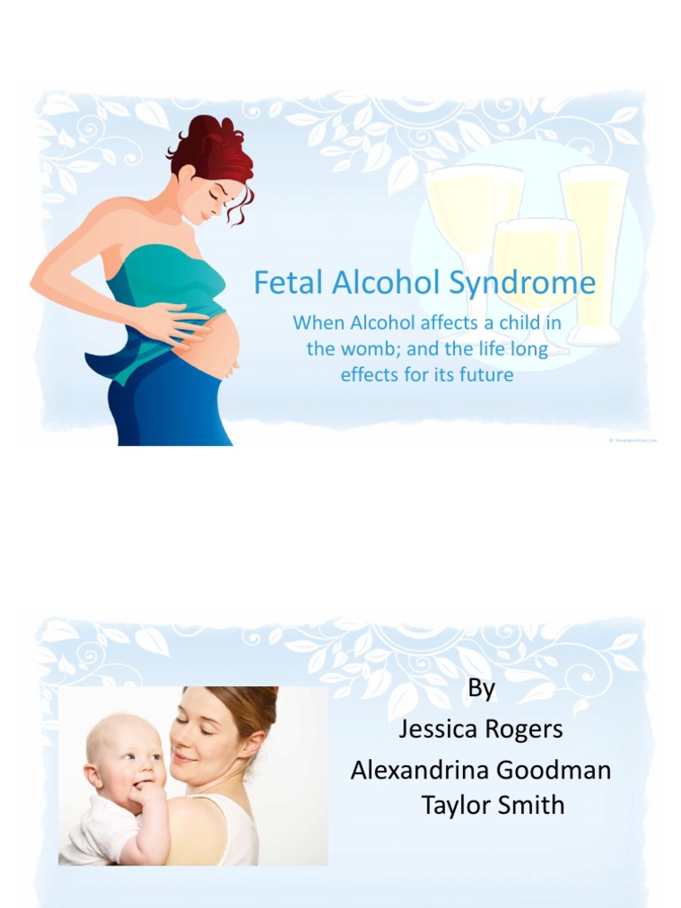 Fetal Alcohol Syndrome | PDF | Alcoholism | Fetus