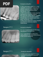 Códigos de Diagnósticos y Tratamientos Yo Procedimientos Dentales en El CIE 10 | PDF | Diente ...