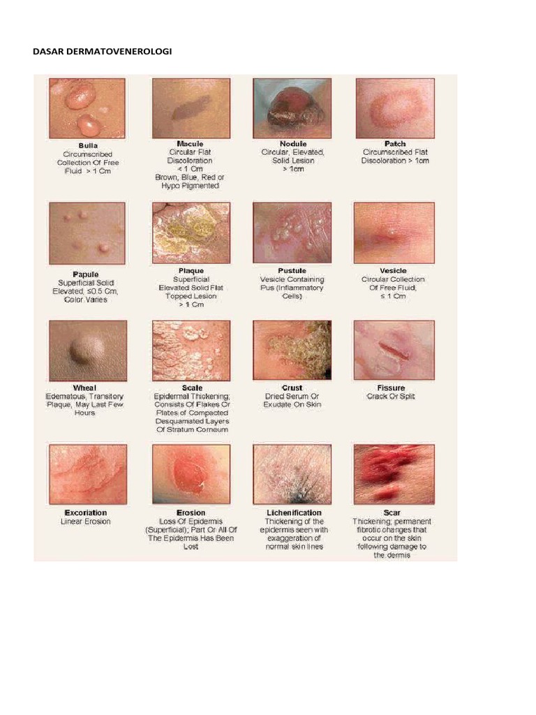 Anamnesis dan Pemeriksaan Dermatologi | PDF
