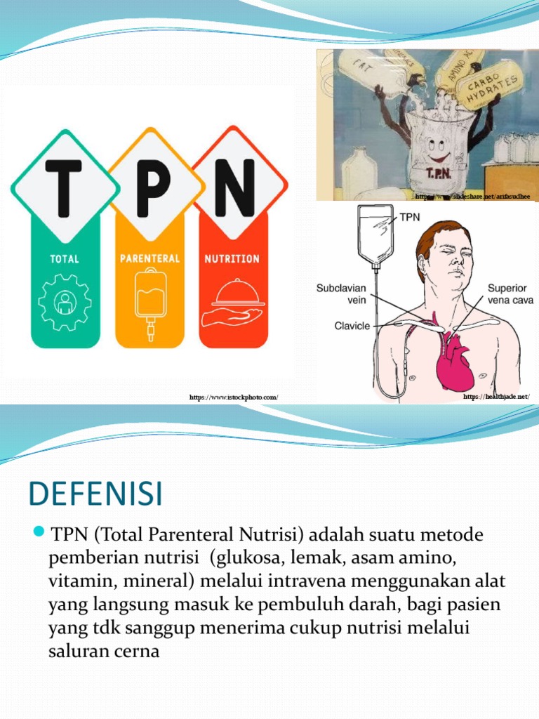 TPN Slide | PDF