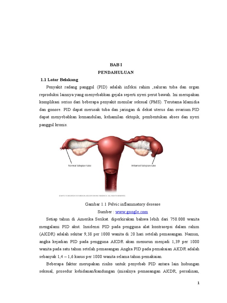 Makalah KEL 2 Pelvis Inflamatory Desease Revisi New | PDF | Pengembangan Diri | Kesehatan Holistik