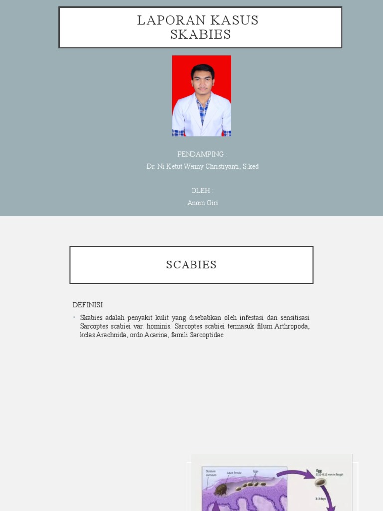 Laporan Kasus SCABIES | PDF