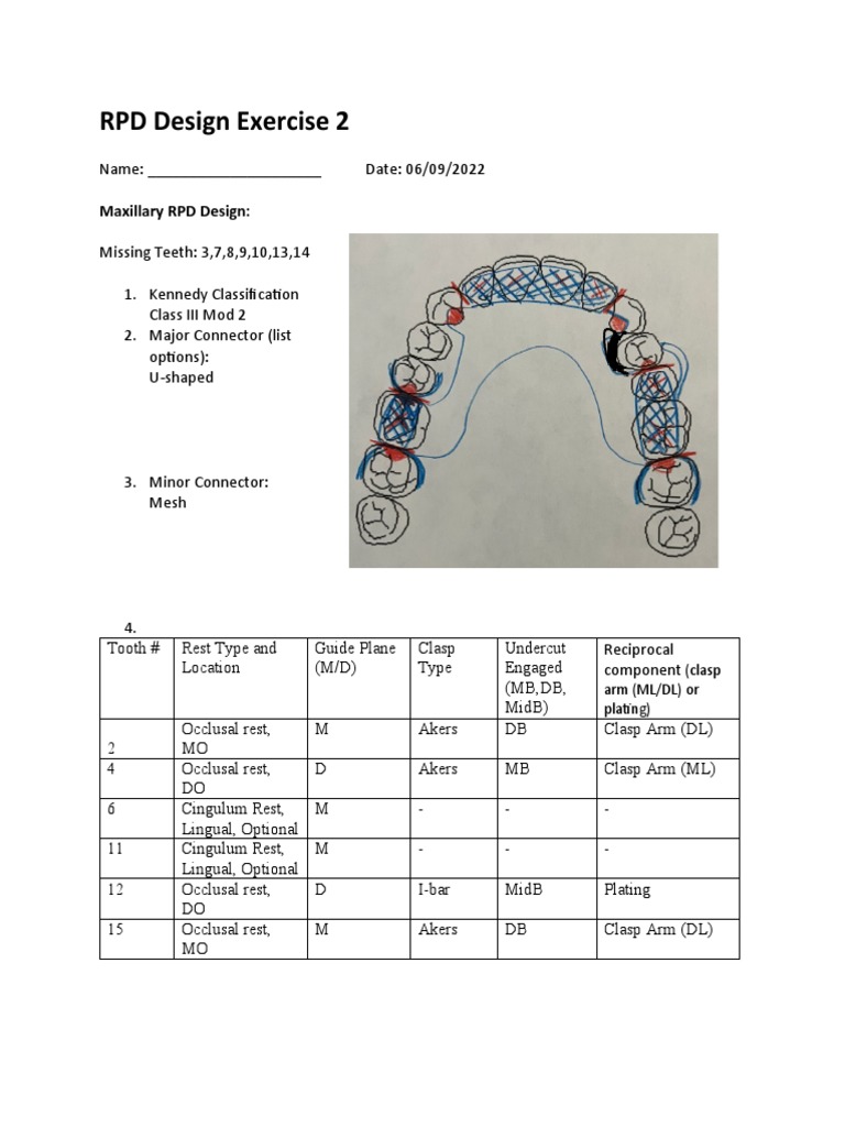 KEY RPD Design Exercise 2 | PDF | History