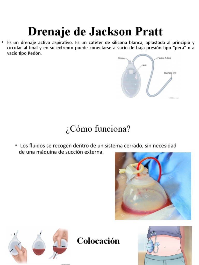 Drenaje de Jackson Pratt | PDF | Abdomen | Drenaje