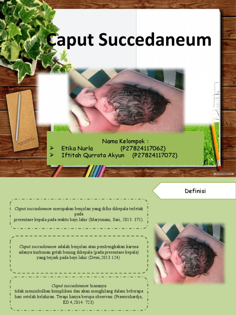 Penanganan Caput Succedaneum pada Bayi | PDF | Kesehatan Holistik ...