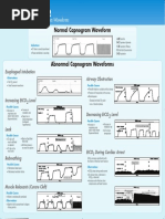 Capnograpy Ems Waveform Reference Card | PDF | Exhalation | Clinical ...