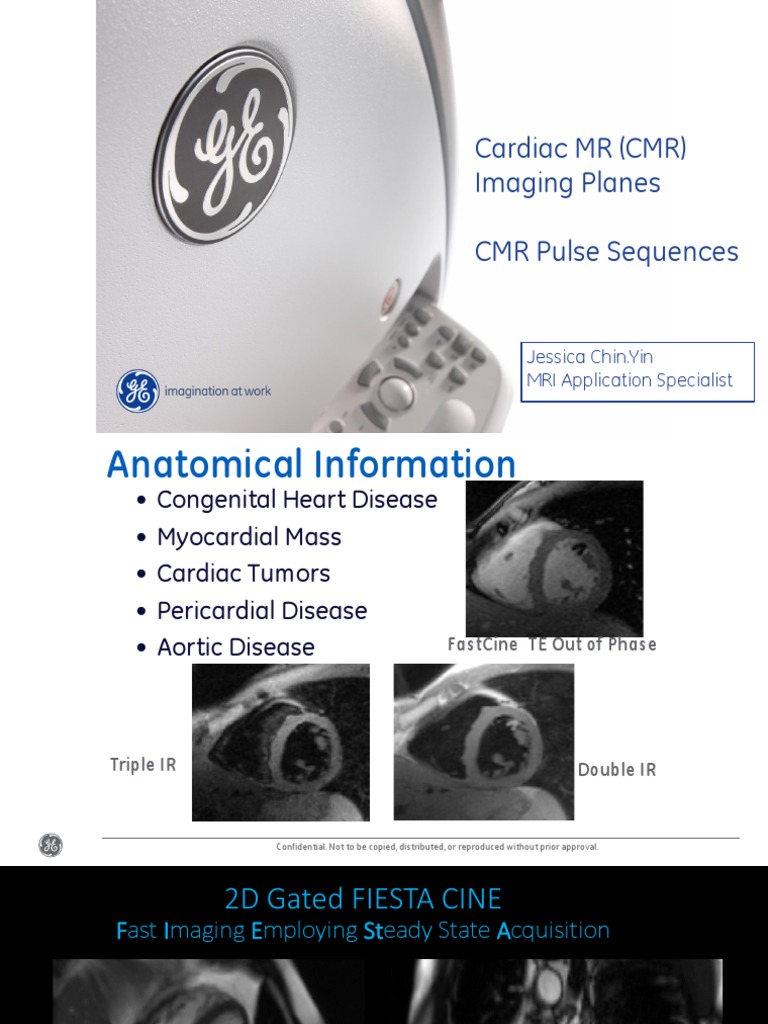 Cardiac MR (CMR) Imaging Planes and Pulse Sequences | PDF | Heart Valve ...