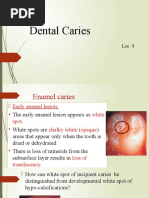 Management of Supraerupted Teeth | PDF | Tooth | Dentistry