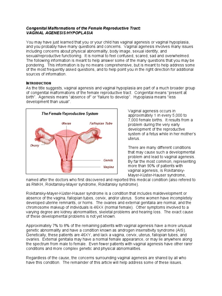 Vaginal Agenesis | PDF | Vagina | Reproductive System