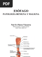 Divertículos Esofágicos | PDF | Músculo esquelético | Esófago