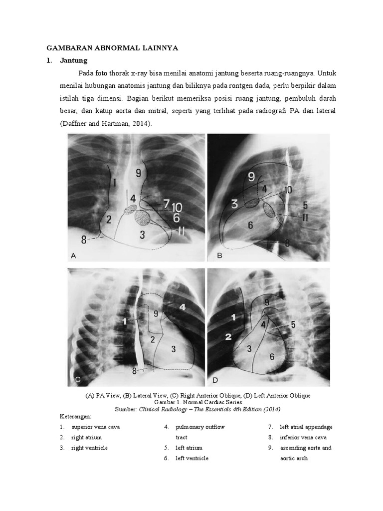 Evaluasi Abnormalitas Jantung dan Tulang X-Ray | PDF | Sains & Matematika