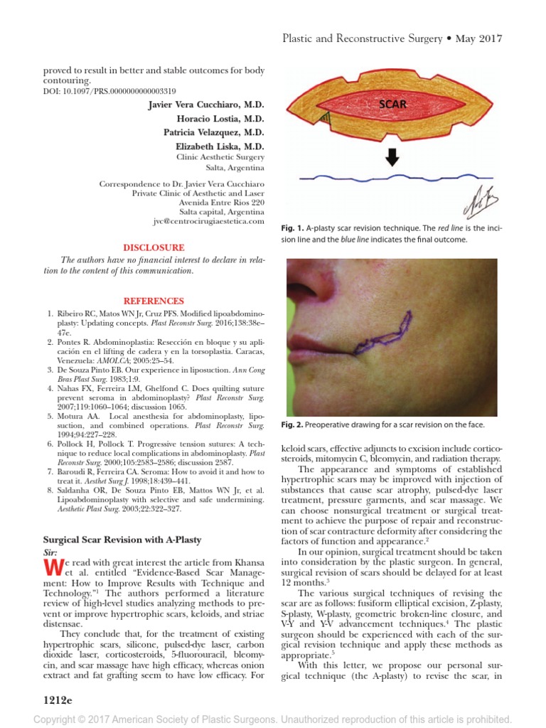 A-Plasty Scar Revision Technique | PDF | Scar | Medicine