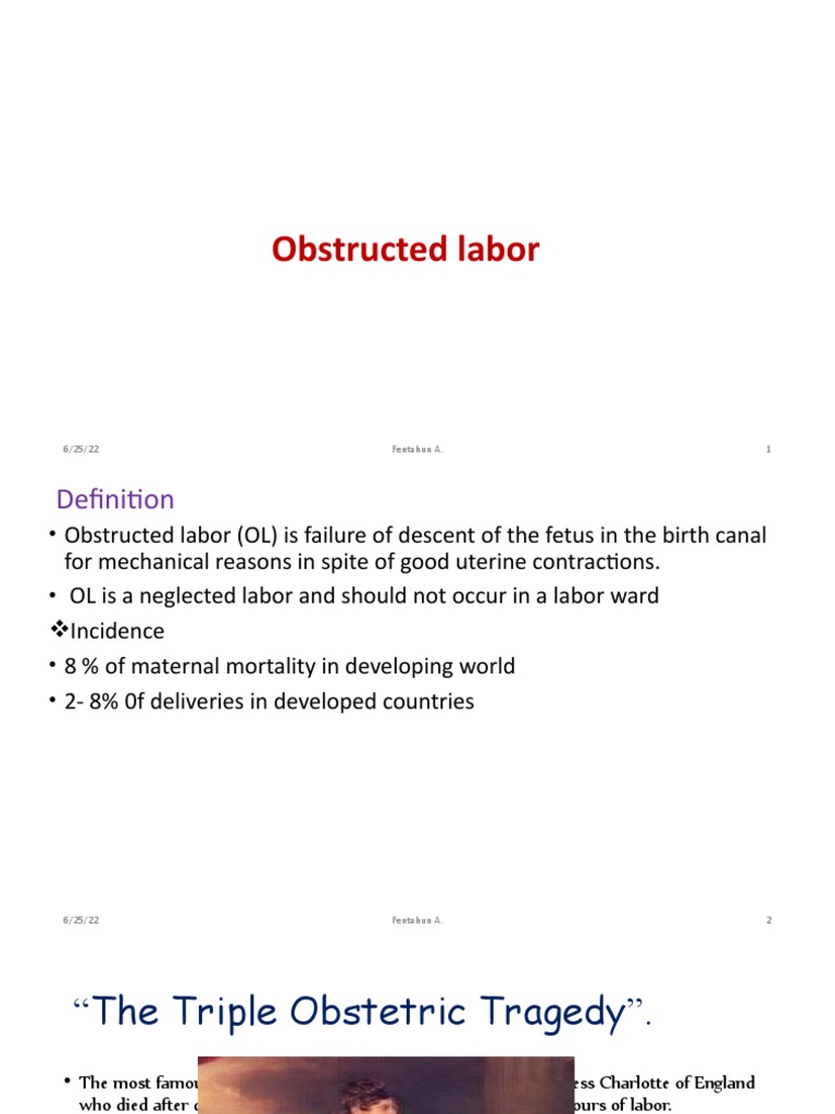 Obstracted Labor | PDF | Childbirth | Health Care