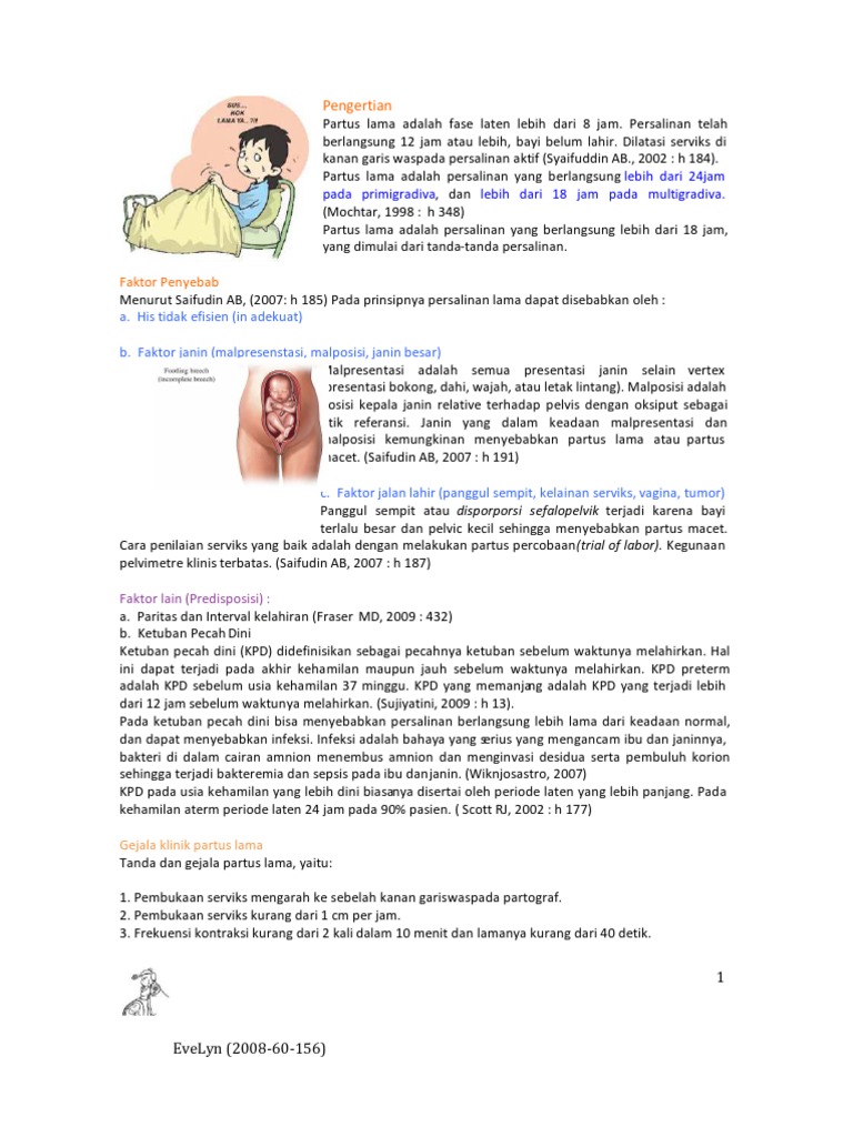 Penyebab dan Penanganan Partus Lama | PDF