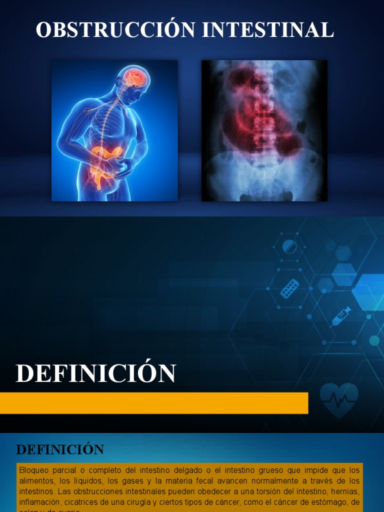 Obstrucción Intestinal: Causas y Tratamiento | PDF | Heces | Intestino ...