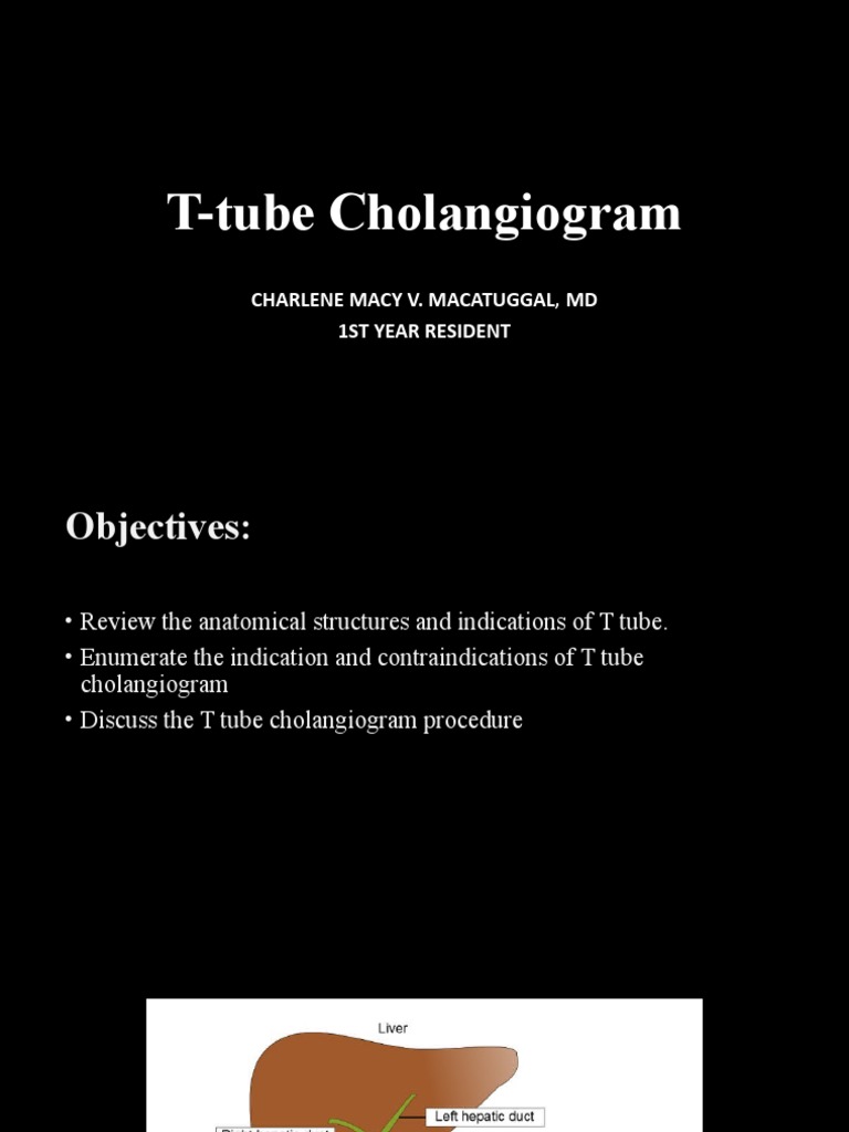 T-Tube Cholangiogram Overview and Procedure | PDF