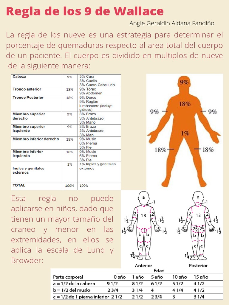 Regla de Los 9 de Wallace | PDF | Ciencias sociales