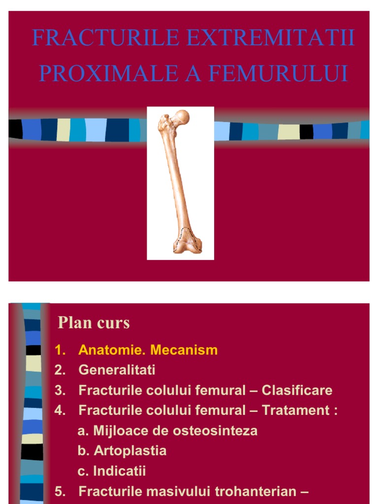 NICOLESCU Fracturi Femur | PDF