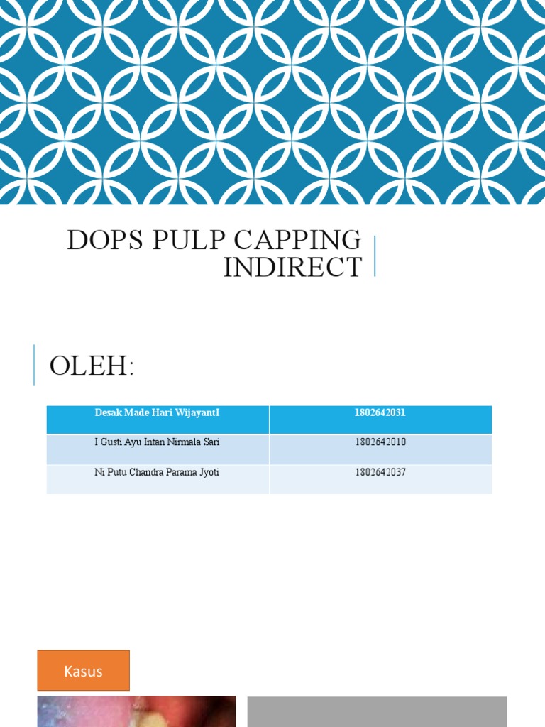 DOPS Indirect Pulp Capping | PDF