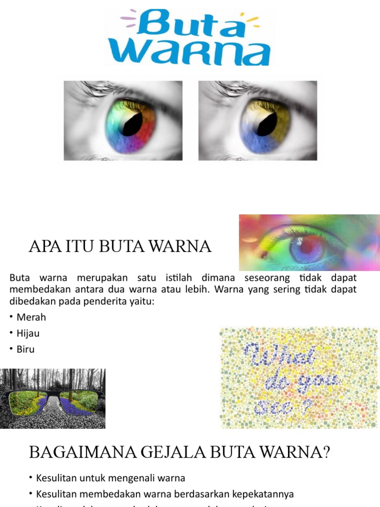 Panduan Lengkap Buta Warna dan Gejalanya | PDF