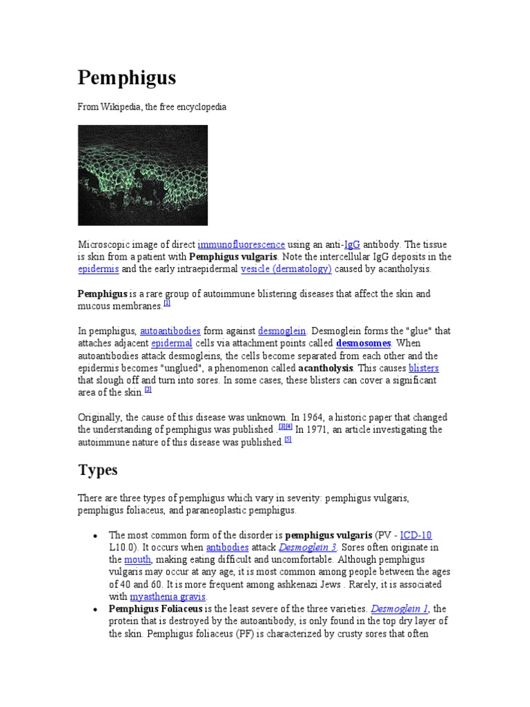 An In-Depth Look at Pemphigus, a Rare and Potentially Fatal Group of ...