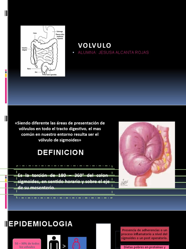 VOLVULO | PDF | Enfermedades y trastornos | Especialidades Medicas
