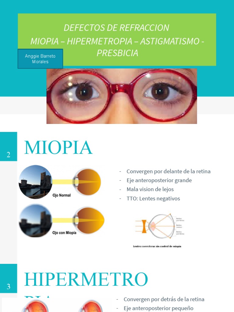 Defectos de Refracción: Miopía, Hipermetropía, Astigmatismo y Presbicia ...