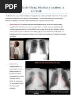 Signos Radiológicos Del Torax | PDF | Pulmón | Tórax
