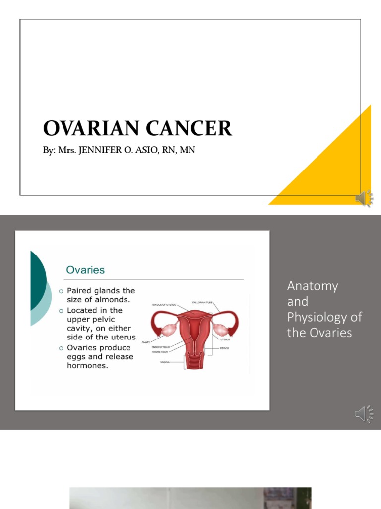 11 NCM 112 Lect Final Ovarian Cancer | Download Free PDF | Ovarian ...