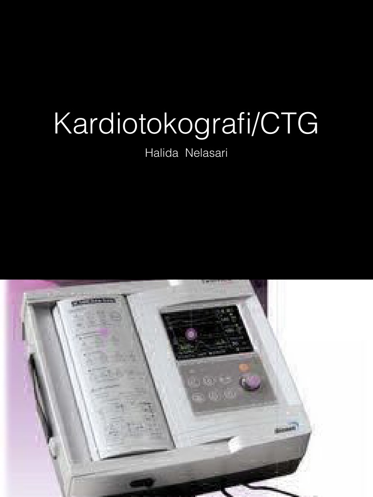 Kardiotokografi/CTG: Halida Nelasari | PDF