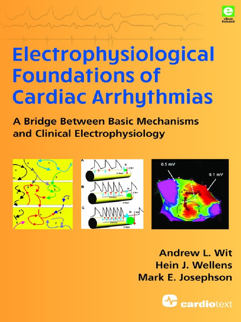 Electrophysiological Foundations of Cardiac Arrhythmias - A Bridge Between Basic Mechanisms and ...