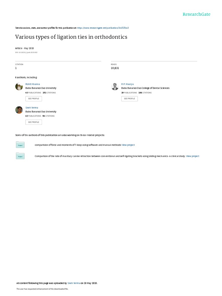 Various Types of Ligation Ties in Orthodontics: Article | Download Free ...