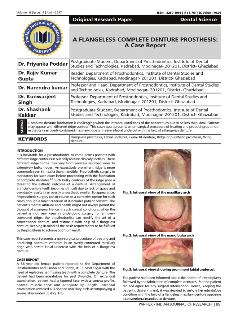 A Flangeless Complete Denture Prosthesis a Case Report April 2017 ...