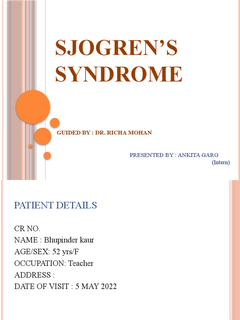 Sjogren'S Syndrome: Guided By: Dr. Richa Mohan | PDF | Clinical ...