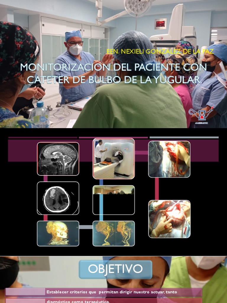 Bulbo de La Yugular | PDF | Isquemia | Hipertensión