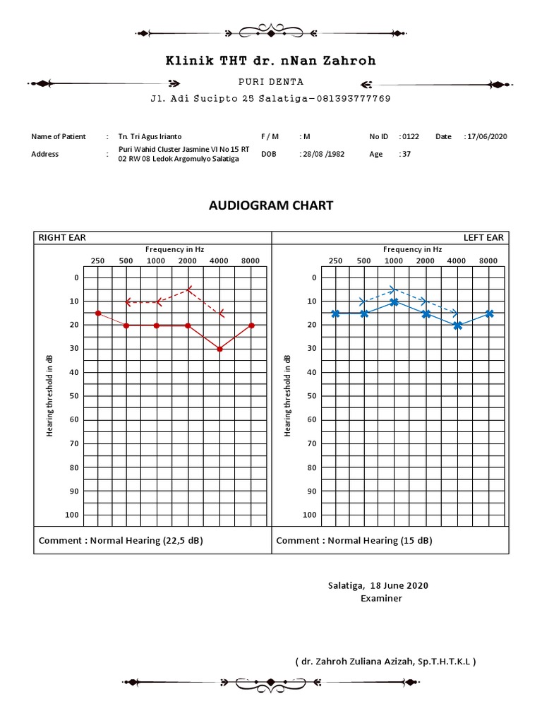 Audiogram Chart: Klinik THT Dr. Nnan Zahroh | PDF | Clinical Medicine ...