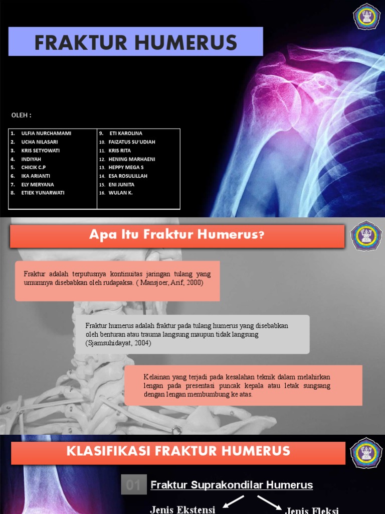 Fraktur Humerus | PDF