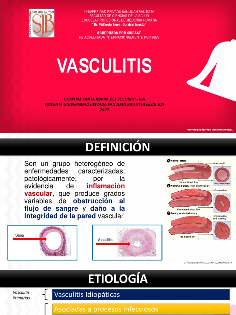 VASCULITIS | PDF | Medicina | Especialidades Medicas