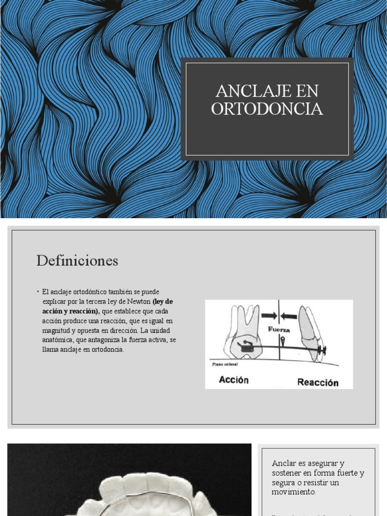 Tipos de Anclaje en Ortodoncia | PDF | Ortodoncia | Las leyes del ...