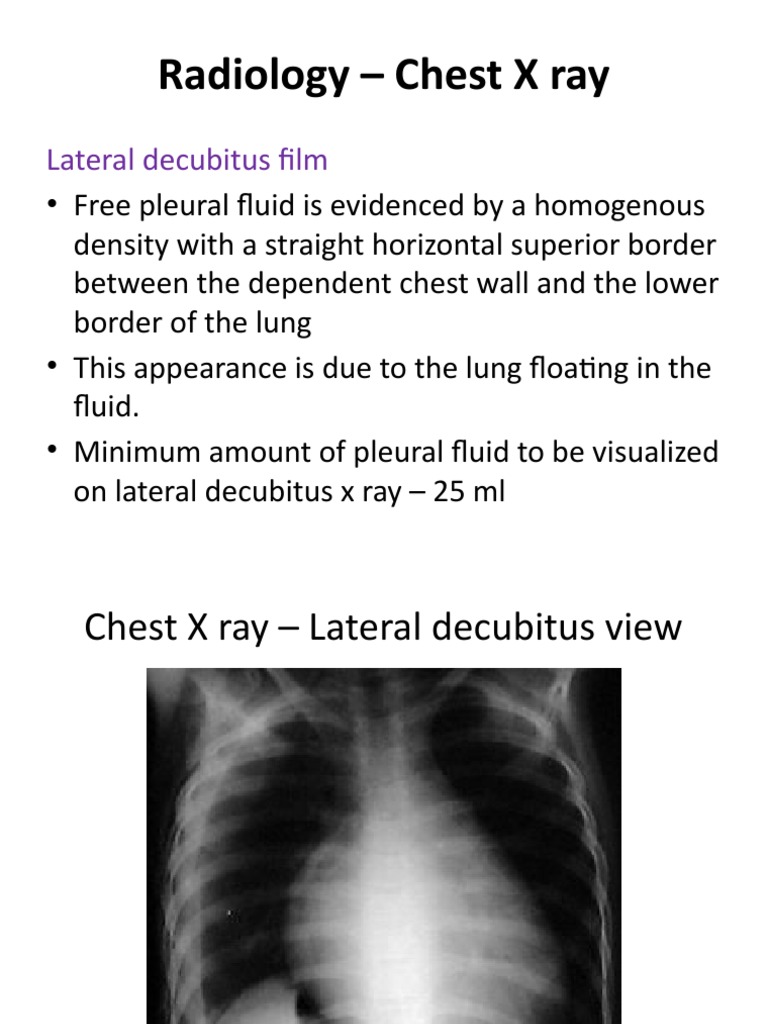 Ultrasonography Pleural Effusion Part 4 - Dr. Sheetu Singh | PDF