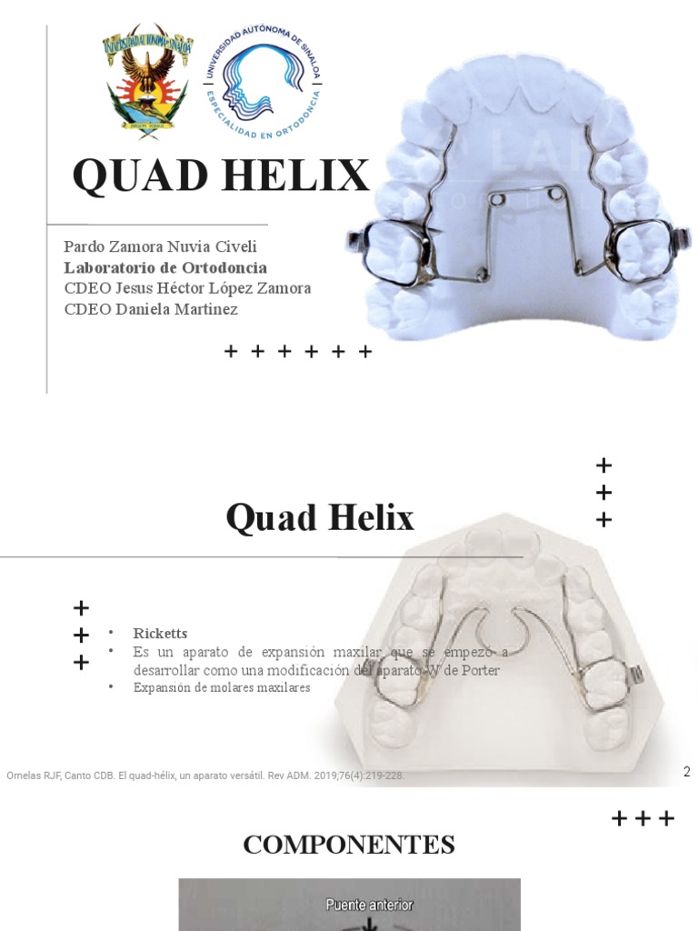 Activación y Uso del Quad Helix | PDF | Ortodoncia | Anatomia dental