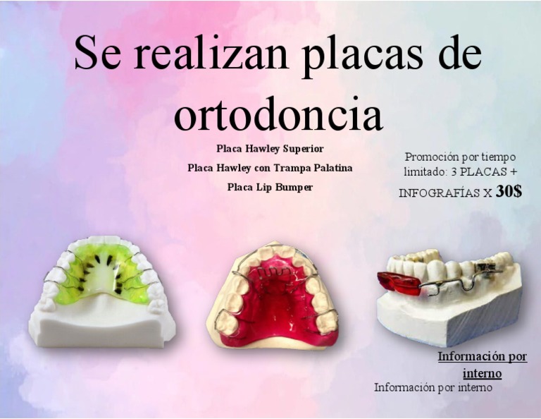 Placa Hawley Superior | PDF