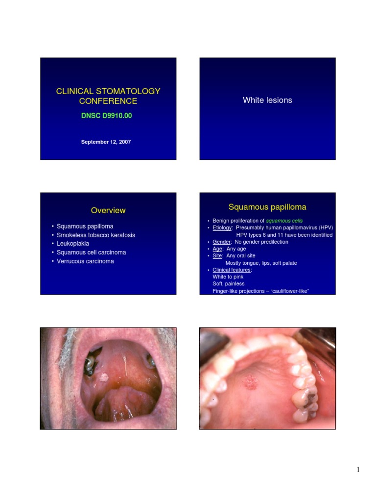 leukoplakia | Cutaneous Conditions | Medical Specialties | Free 30-day ...