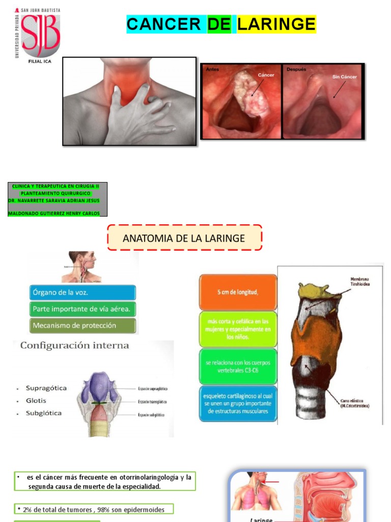 ca laringe | PDF | Cáncer | Medicina CLINICA